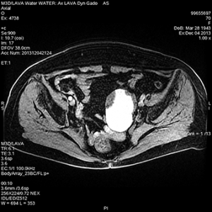 IRM Pelvienne - Radiologie et Imagerie Médicale Tzanck